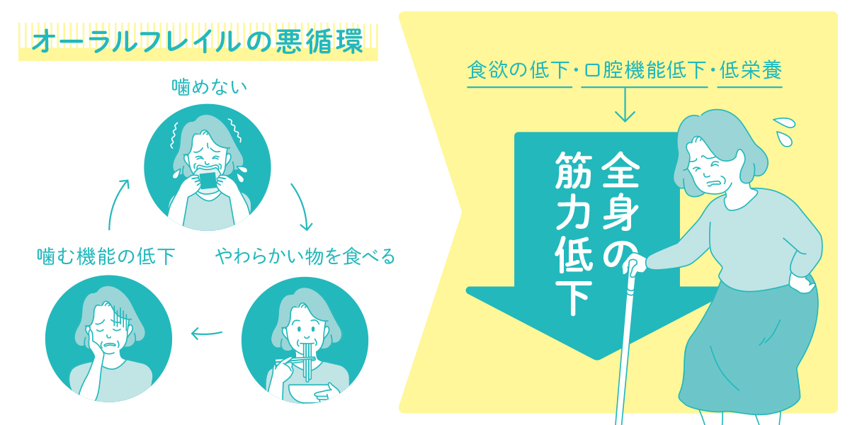 The vicious cycle of oral frailty | Minoh Dental Clinic